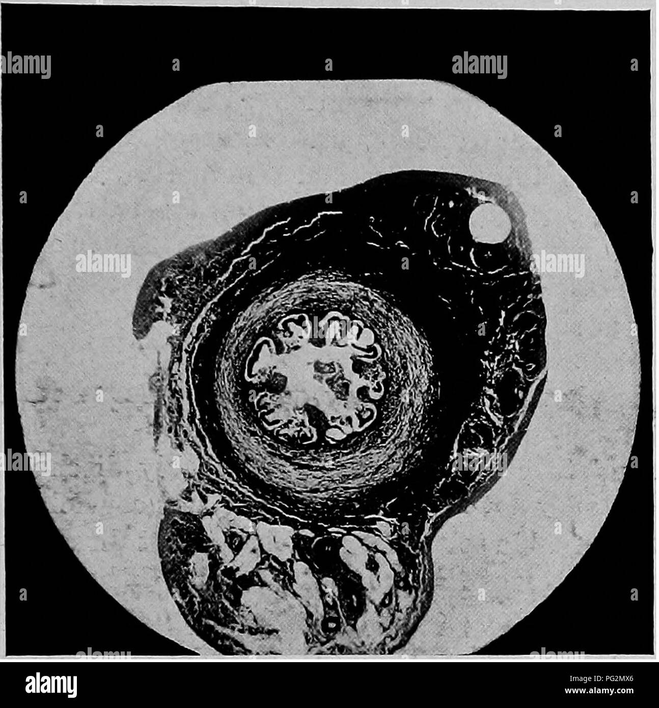 This veterinary illustration depicts chronic catarrhal salpingitis in ...