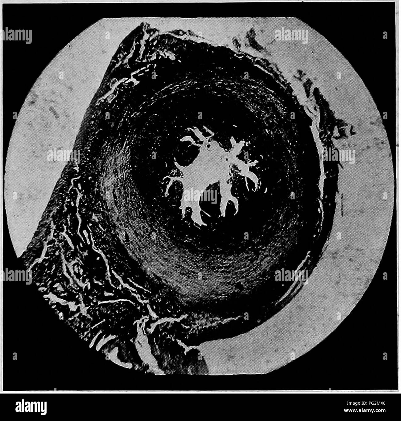 Two circular layers Black and White Stock Photos & Images - Alamy