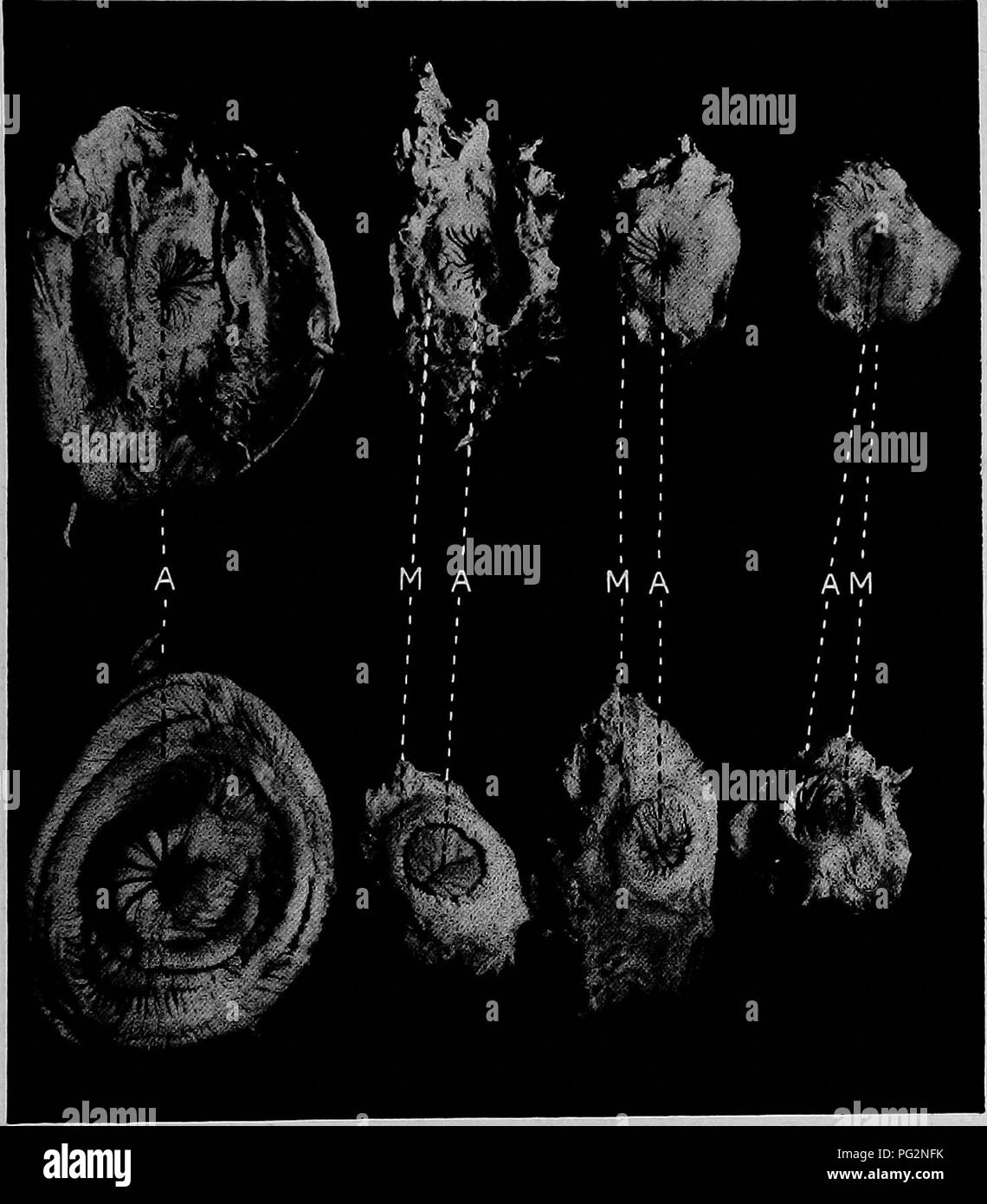 Rugae hi-res stock photography and images - Alamy