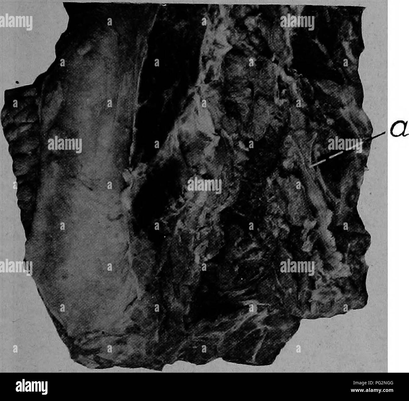 This text addresses the pathology and diagnosis of infectious diseases ...