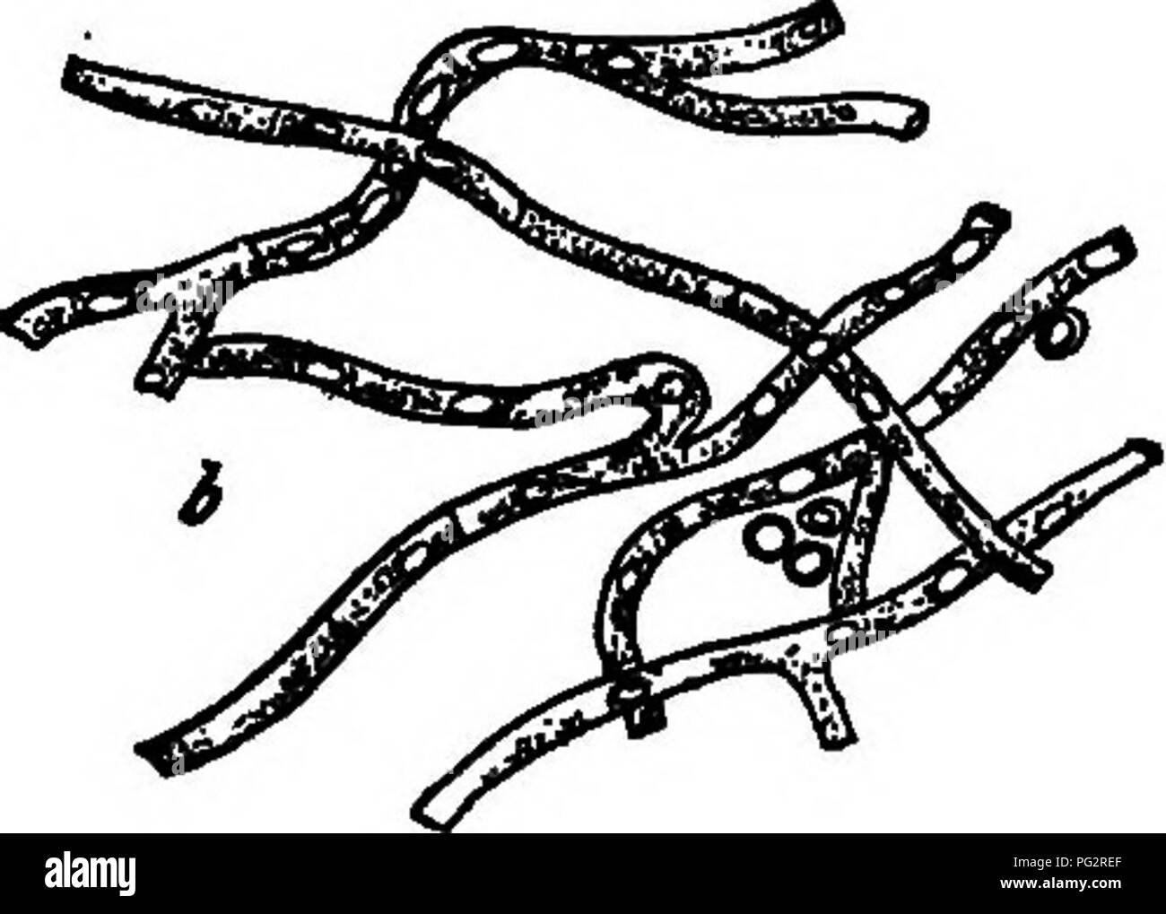 Scalp bacteria Black and White Stock Photos & Images - Alamy