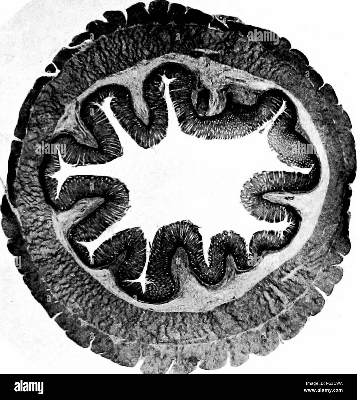 Large intestine microscope hi-res stock photography and images - Alamy