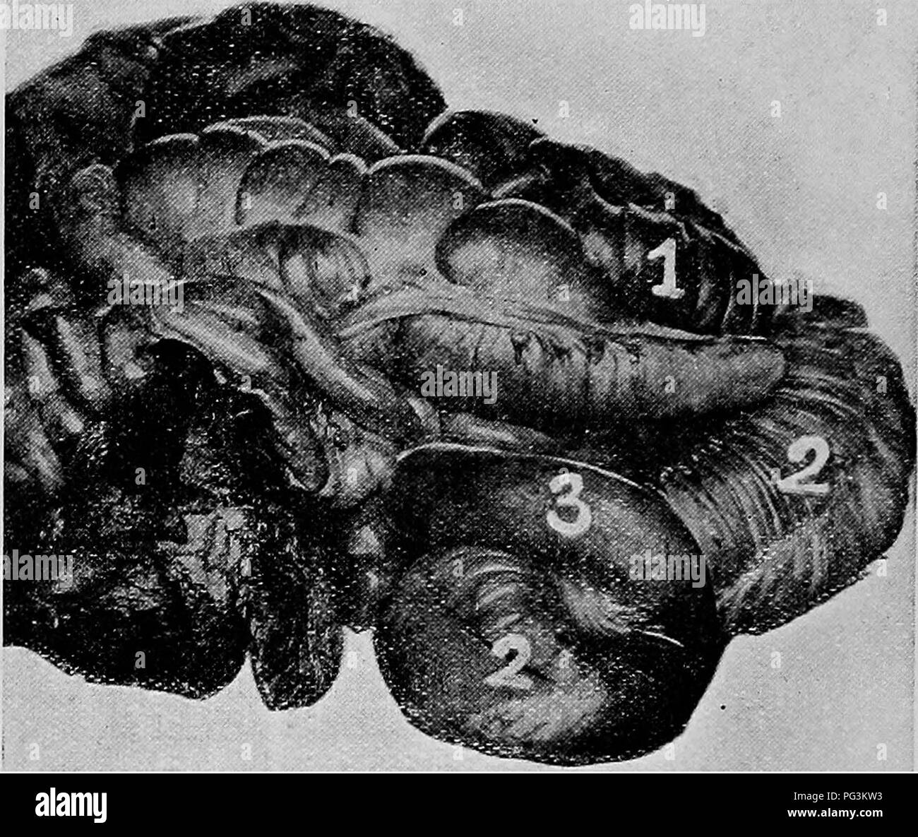 This guide discusses the causes, symptoms, diagnosis, and treatment of ...