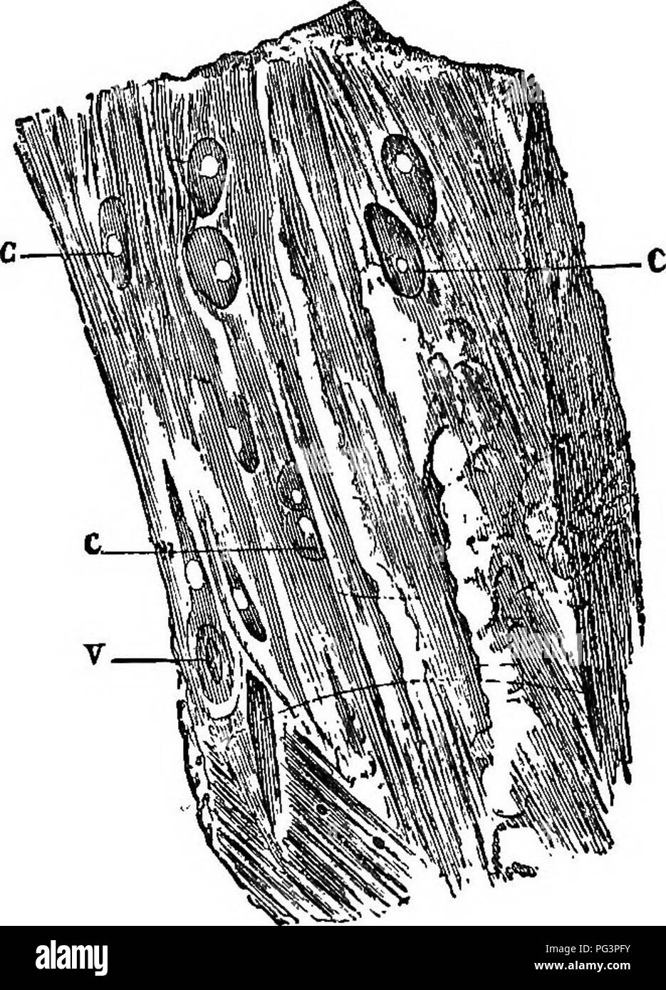 Bladder worm hi-res stock photography and images - Alamy