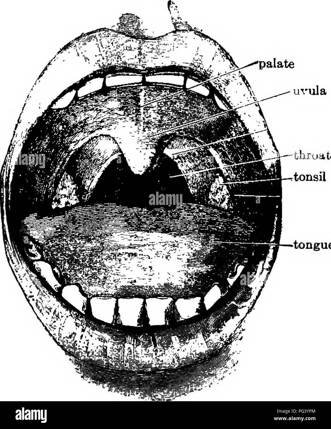 Uvula Mass
