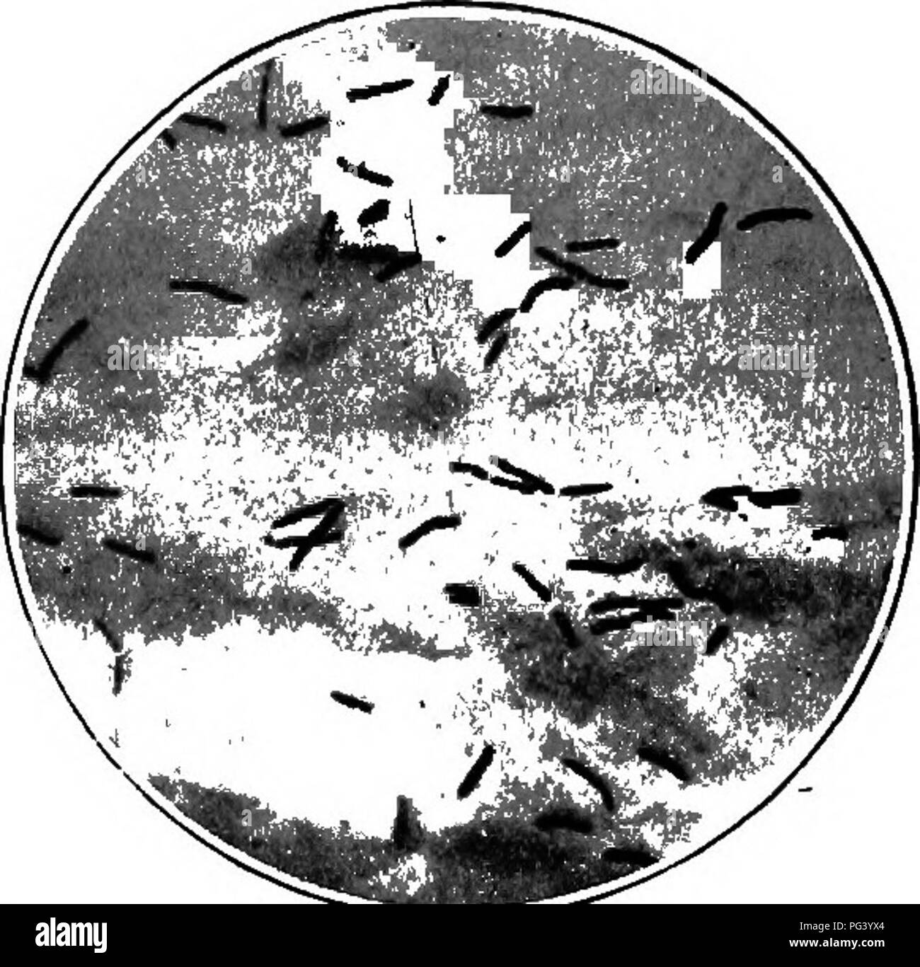 Tuberculosis a great plague hi-res stock photography and images - Alamy