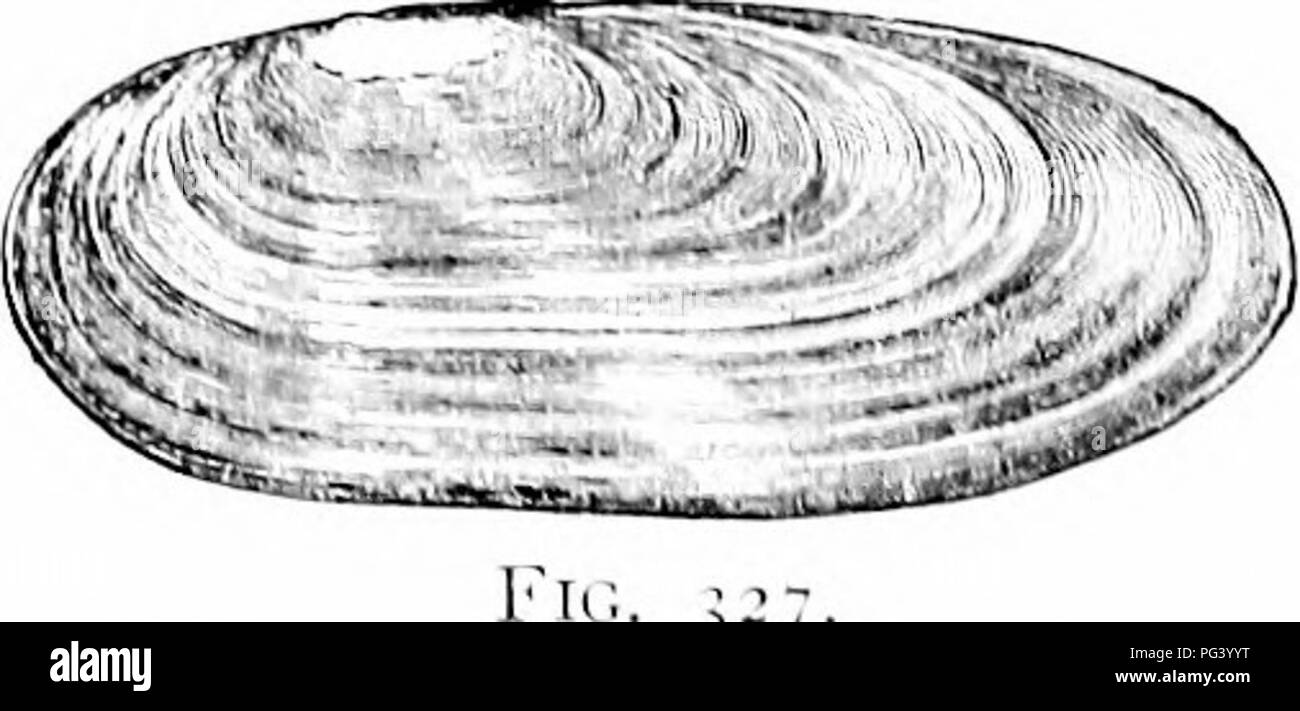 The image in this entry features a detailed anatomical illustration of ...