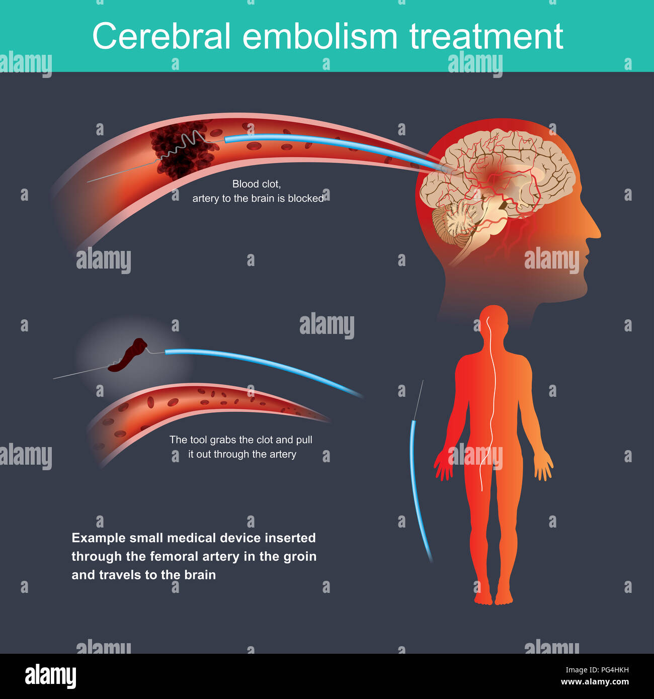 Human groin hi-res stock photography and images - Alamy