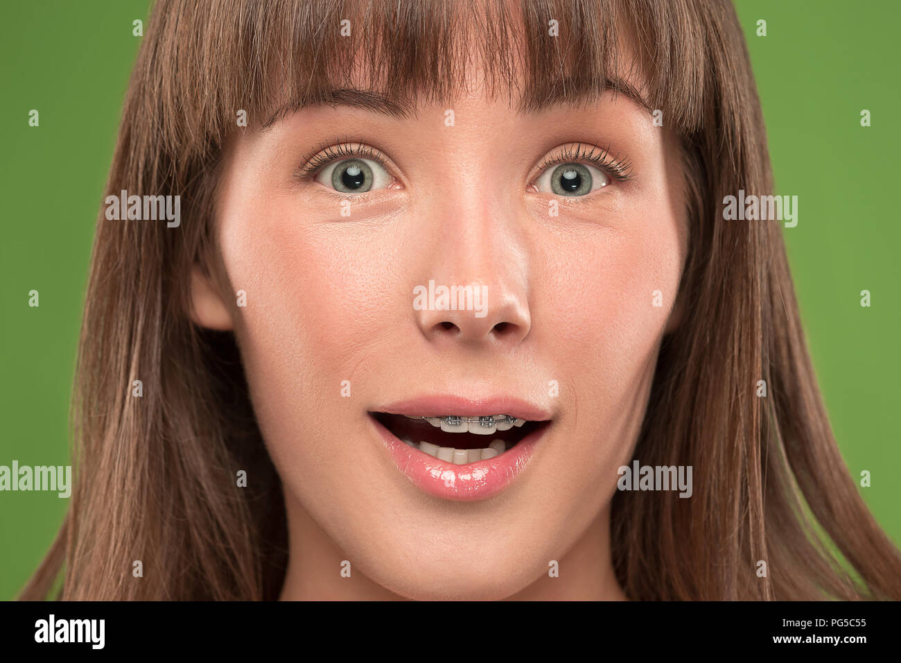 Beautiful young surprised woman with teeth braces on green Stock Photo ...