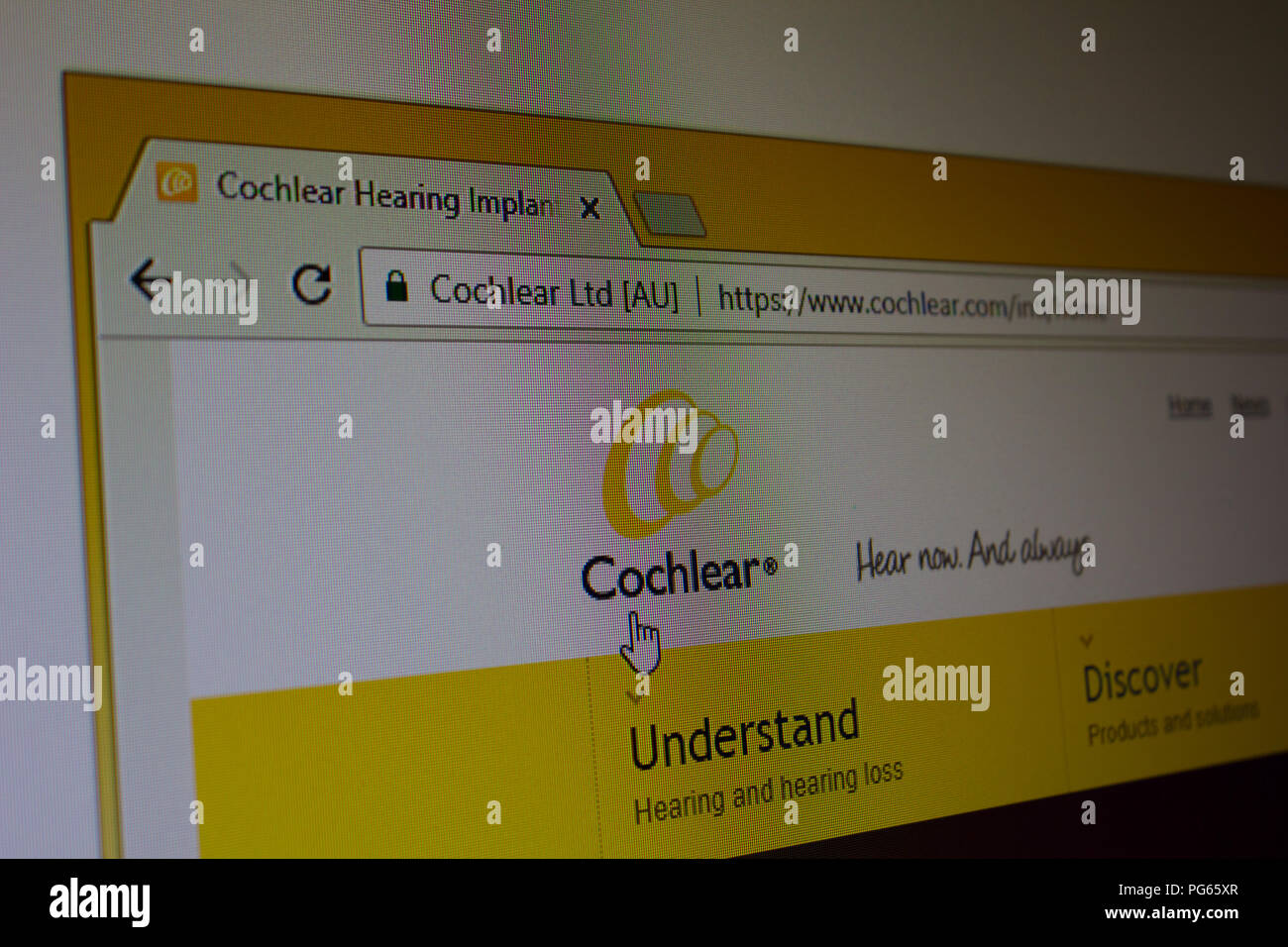 Cochlear implant hi-res stock photography and images - Alamy