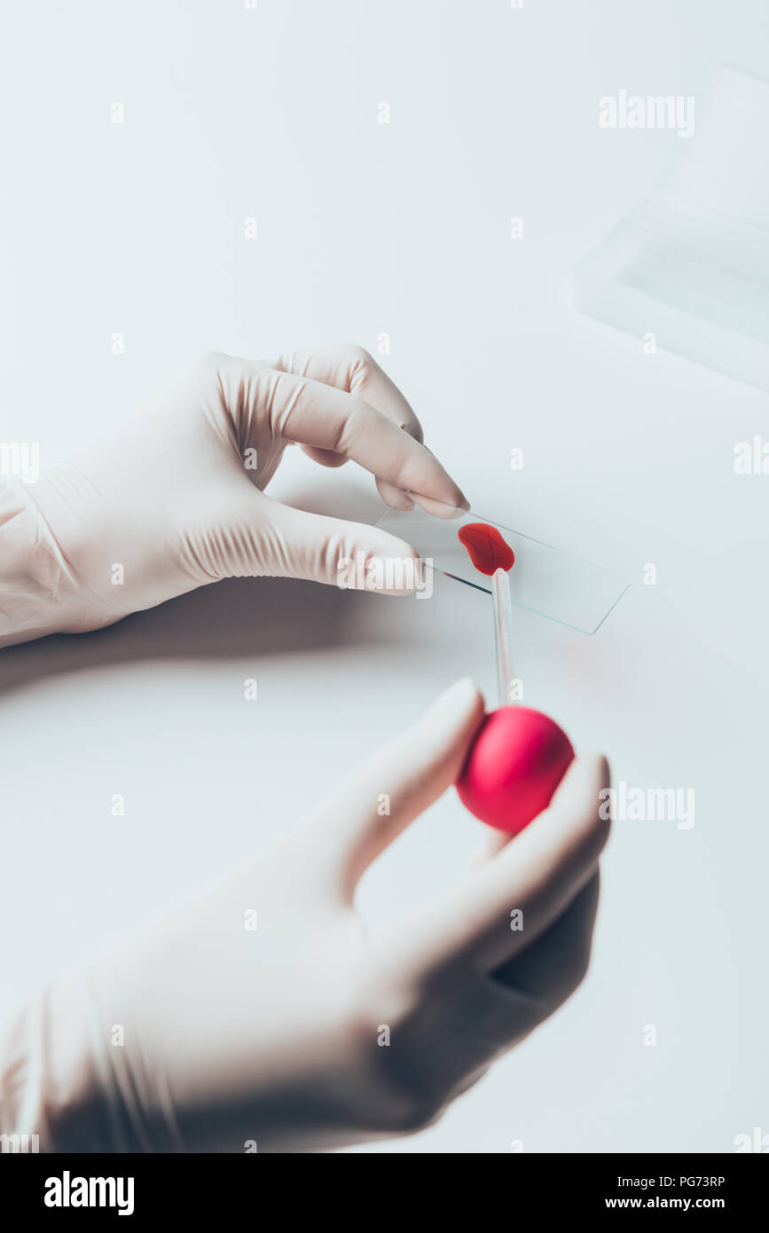 Blood slide hi-res stock photography and images - Alamy