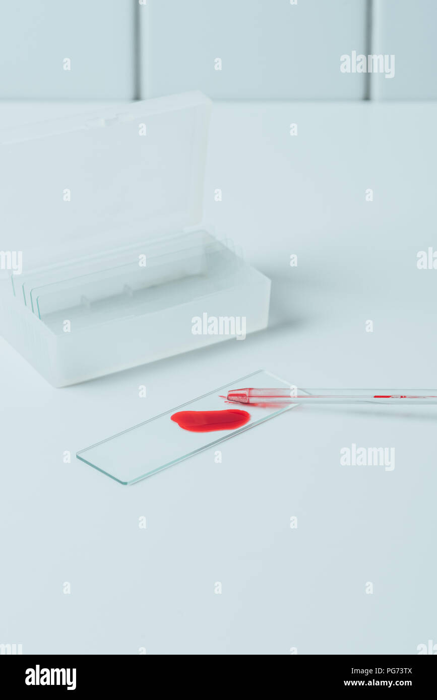 blood sample on glass slide with pipette on white table Stock Photo - Alamy