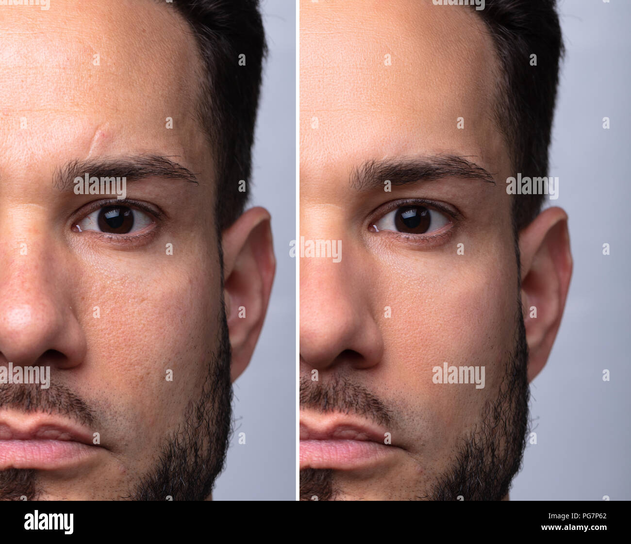 Photo editing before after face hi-res stock photography and images - Alamy