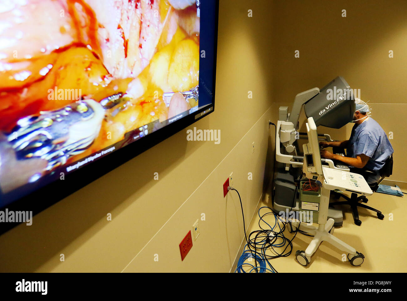 August 24, 2018 - Davenport, Iowa, U.S. - Using the da Vinci Surgical ...