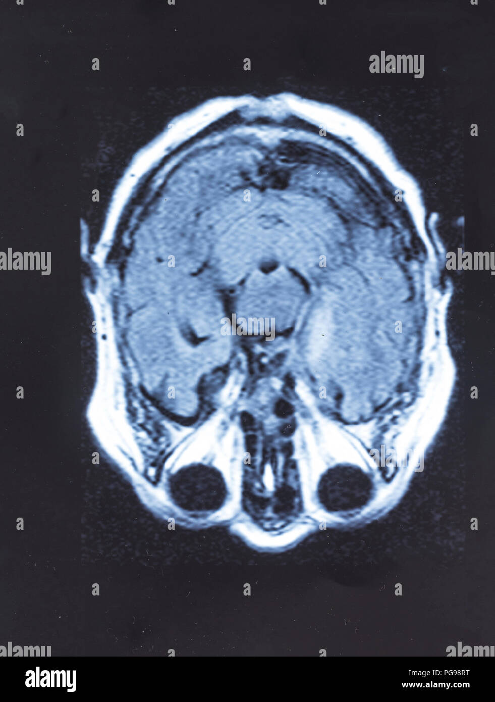 Human brain, magnetic resonance imaging (MRI) scan Stock Photo - Alamy