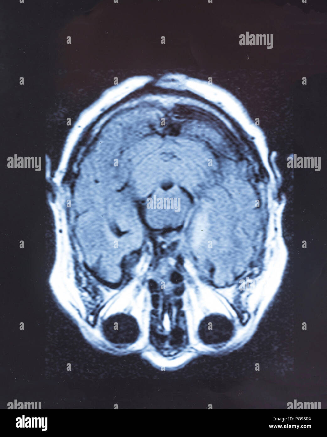 Human brain, magnetic resonance imaging (MRI) scan Stock Photo - Alamy Human brain, magnetic resonance imaging (MRI) scan Stock Photo - Alamy