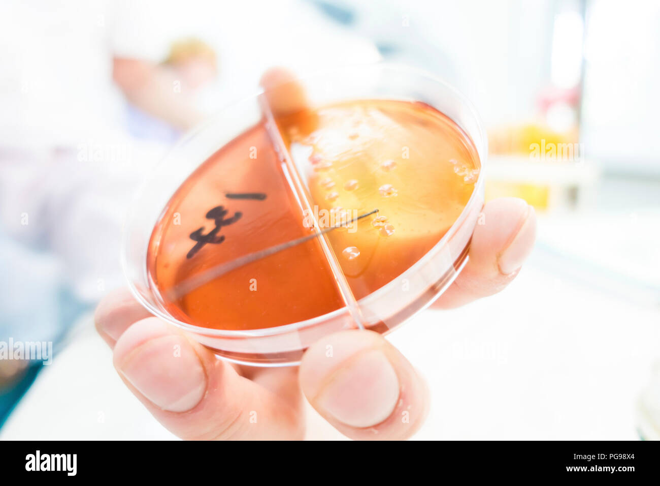 Agar plate hi-res stock photography and images - Alamy