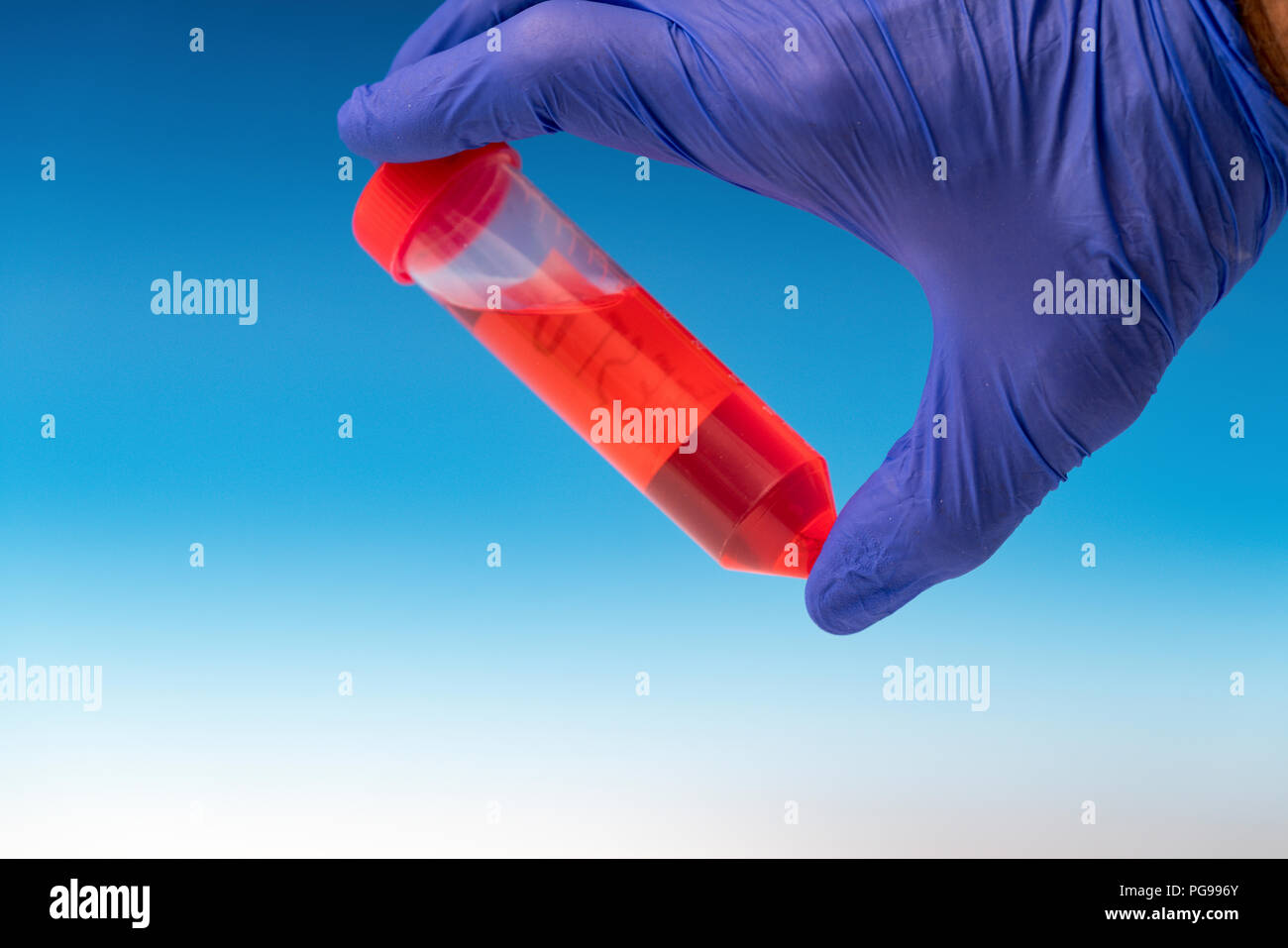 Sample in test tube Stock Photo - Alamy