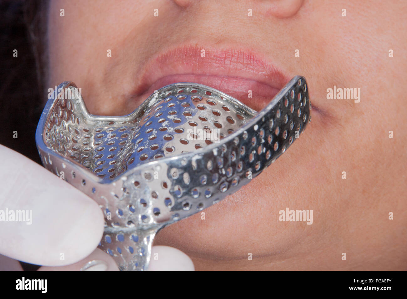 oral rehabilitation process, partial removable prosthesis Stock Photo ...