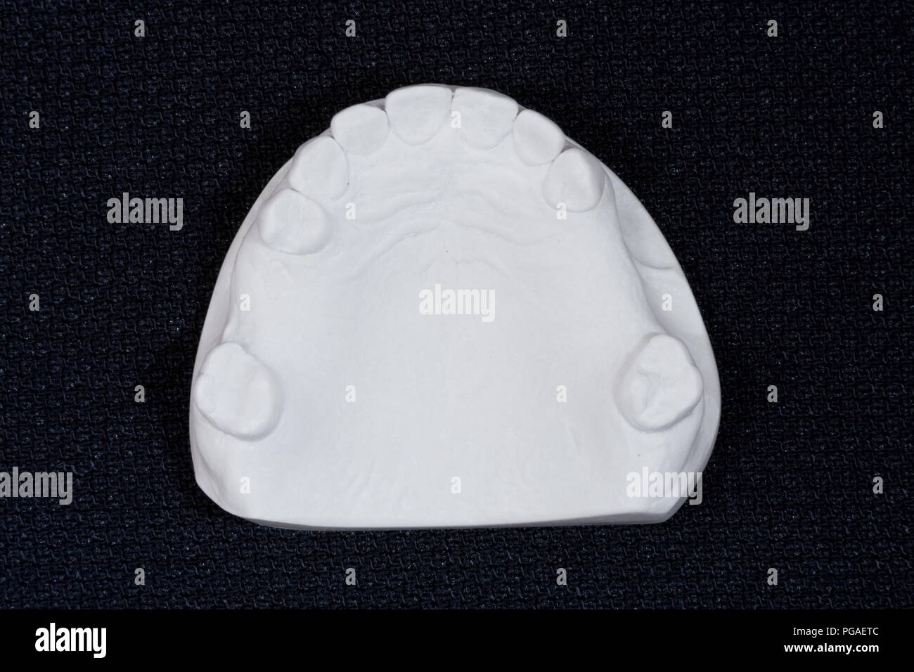 oral rehabilitation process, partial removable prosthesis Stock Photo ...