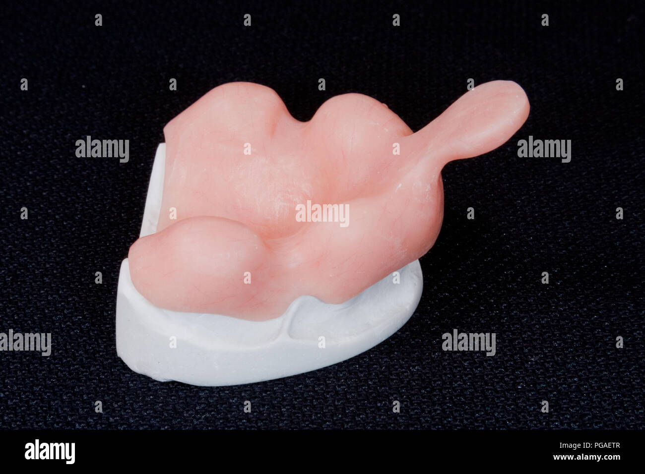 oral rehabilitation process, partial removable prosthesis Stock Photo ...