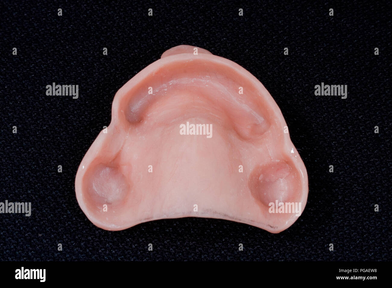 oral rehabilitation process, partial removable prosthesis Stock Photo ...