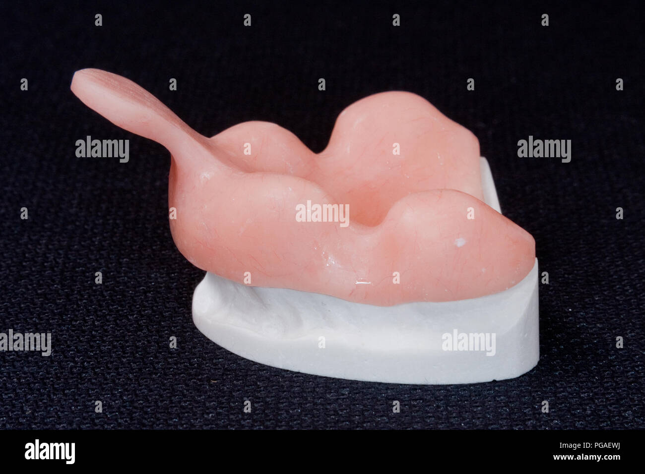 oral rehabilitation process, partial removable prosthesis Stock Photo ...