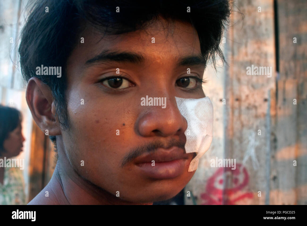 A young impoverished Cambodian man is wearing a medicinal patch on his ...