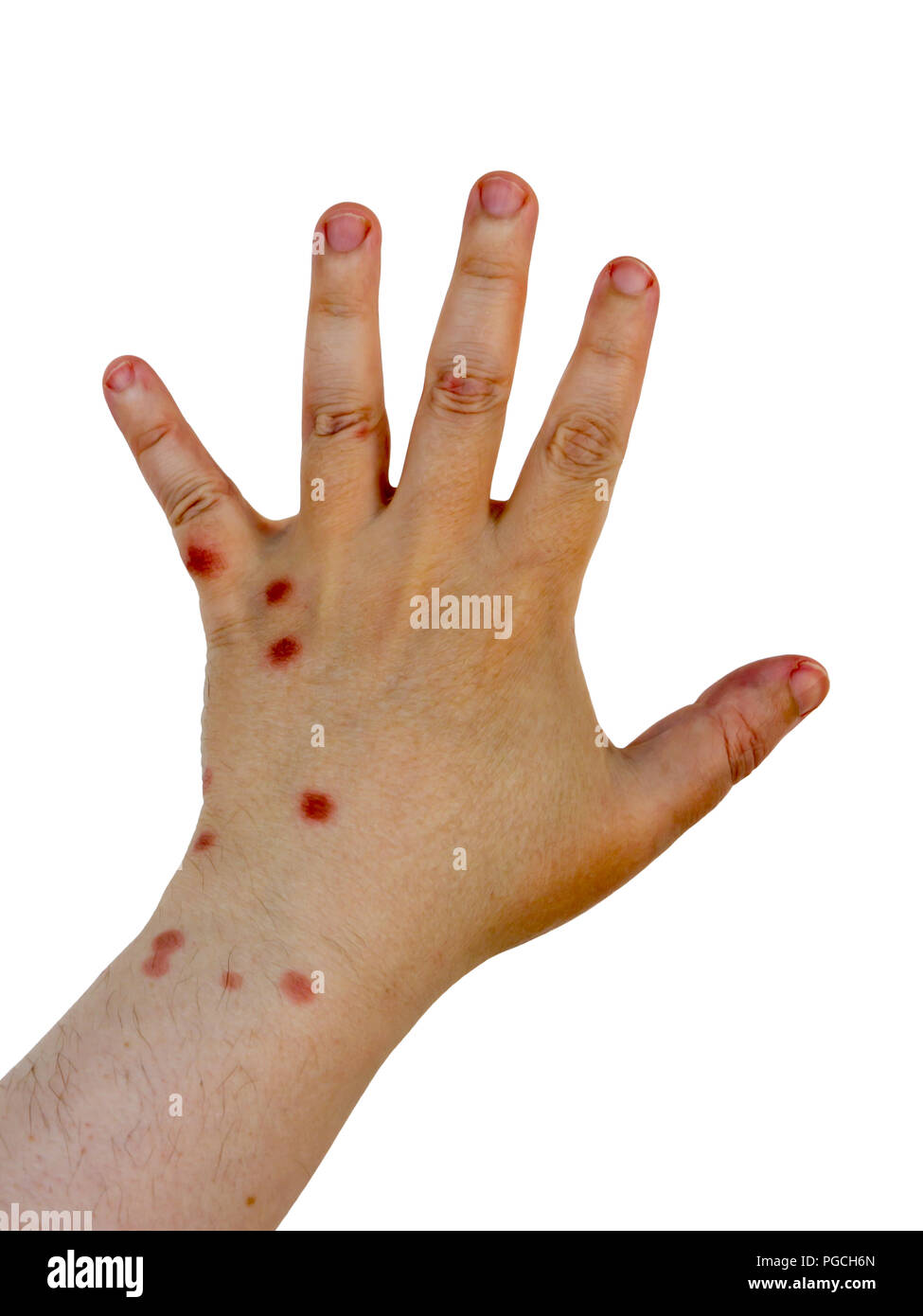 Sulfuric Acid On Hand