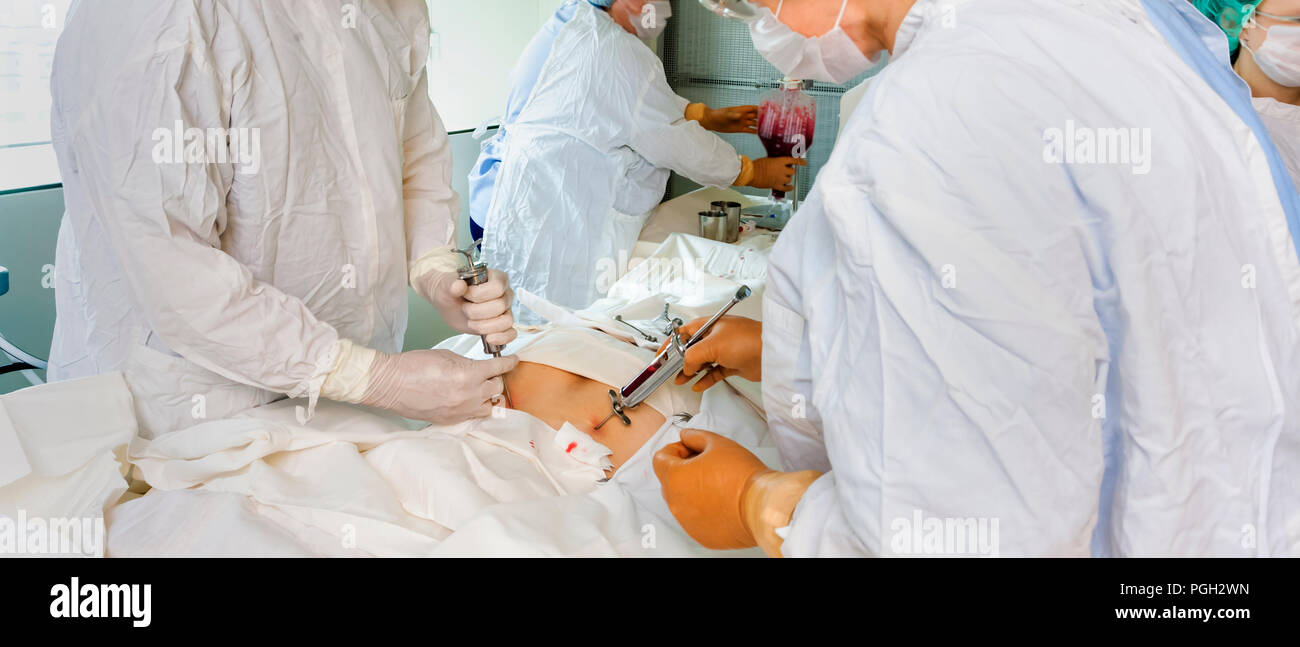 bone marrow transplant operation Stock Photo - Alamy