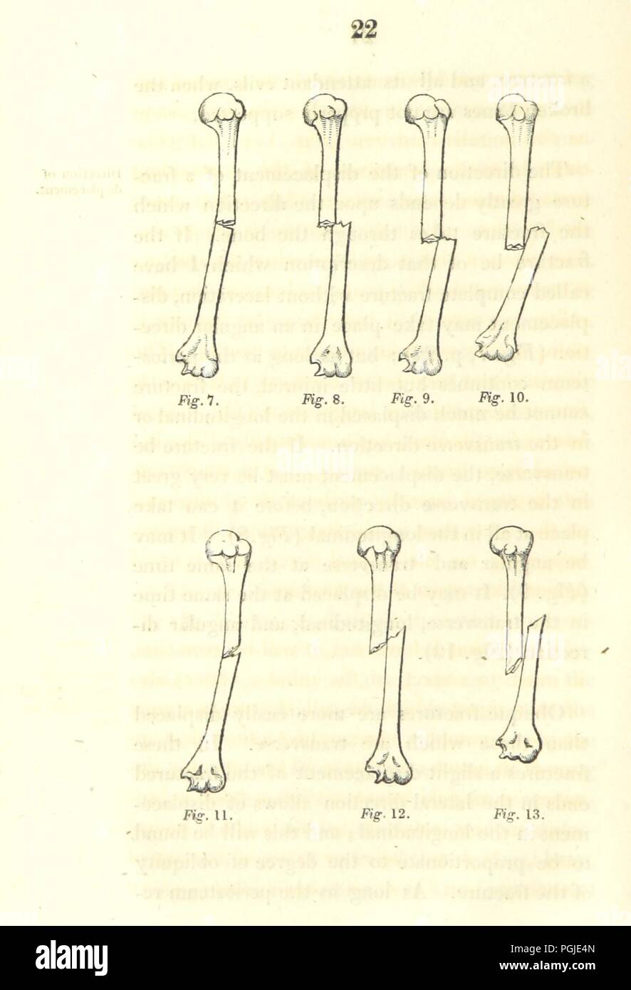 Image from page 40 of 'Practical Remarks on the Nature and Treatment of ...