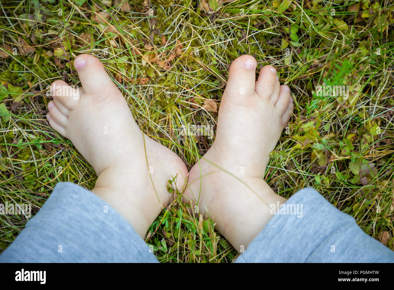 Down Syndrome Girl High Resolution Stock Photography and Images - Alamy