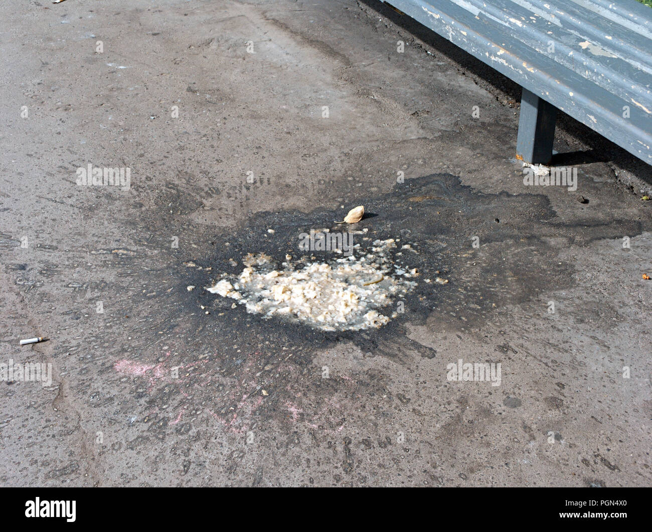 Street vomit hi-res stock photography and images - Alamy
