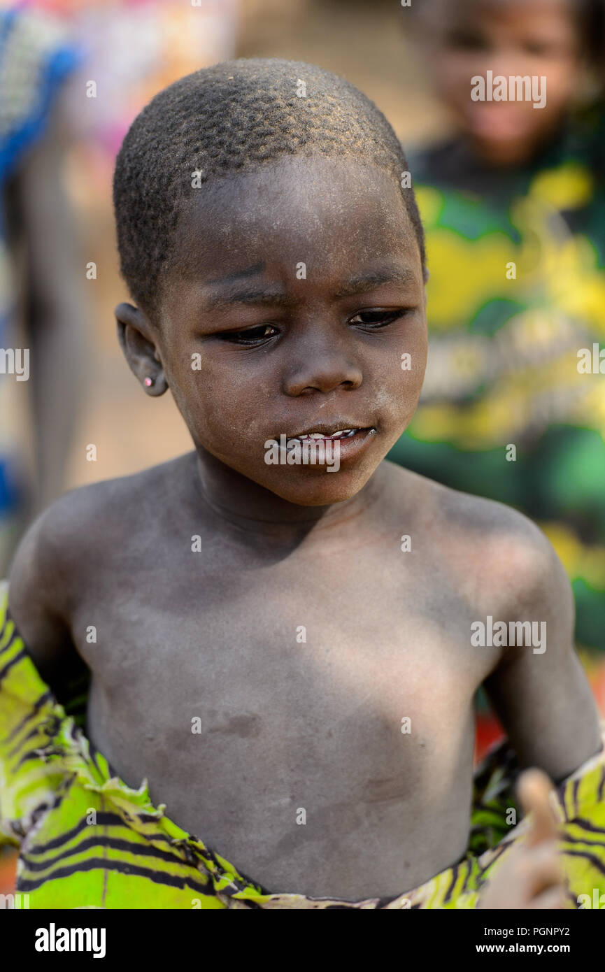 GHANI, GHANA - JAN 14, 2017: Unidentified Ghanaian little soiled girl ...