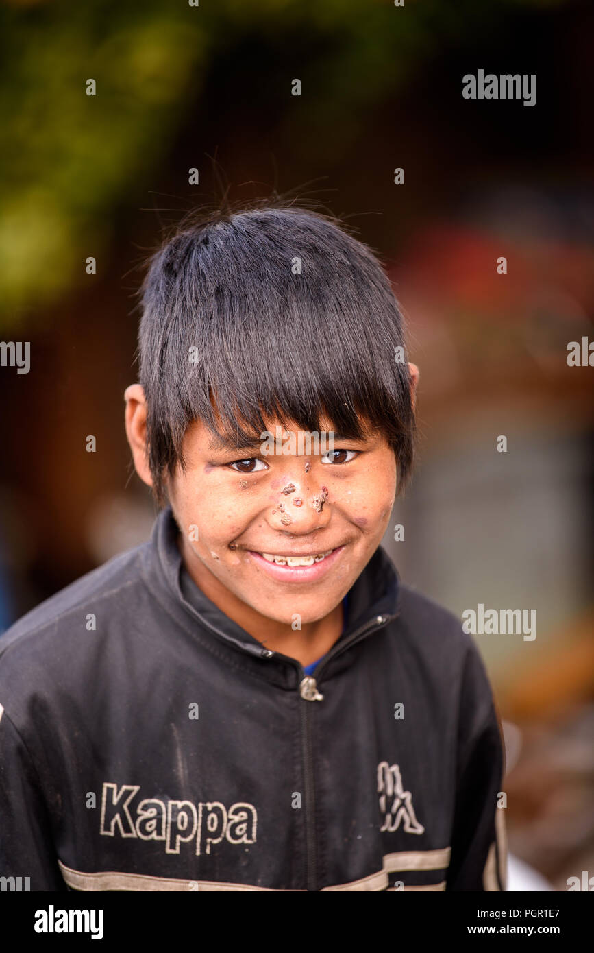 TRIMPHU, BHUTAN - MAR 8, 2017: Unidentified Ngalops boy with dirty face ...