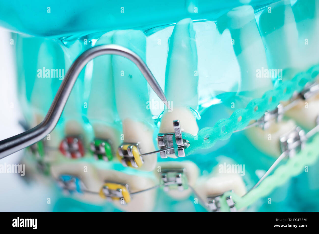 Dental metal braces teeth retainer aligners teaching orthodontics model ...