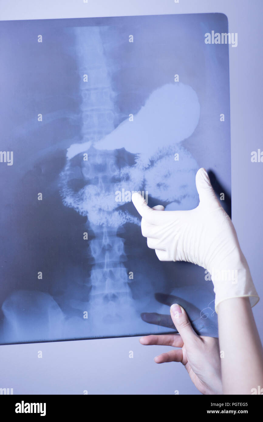 Medical hospital x-ray lowe back pain spine and hips traumatology scan ...