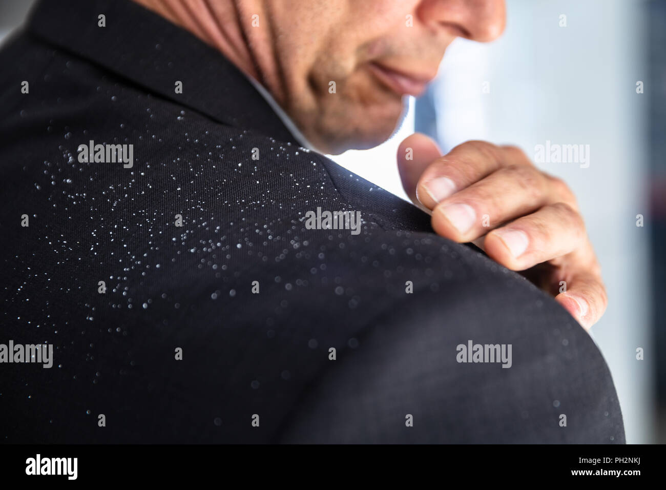 Close-up Of A Businessman's Hand Brushing Off Fallen Dandruff On ...