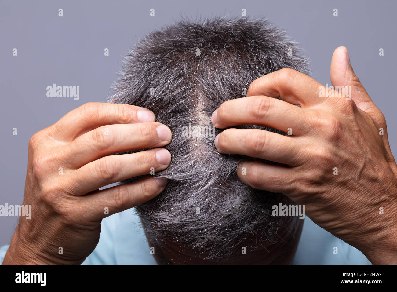 Old man scratching head hi-res stock photography and images - Alamy