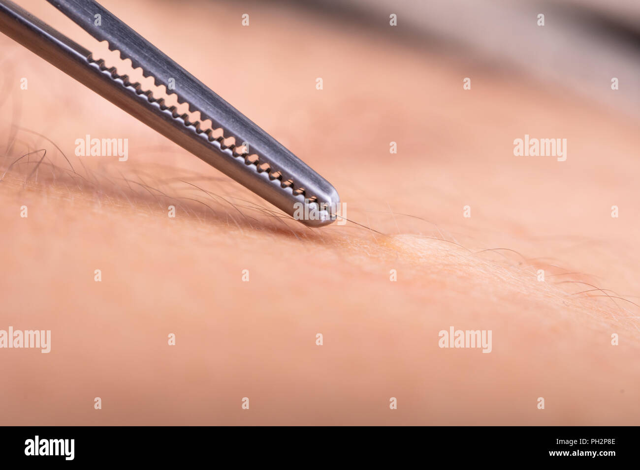 Pull out the detail hi-res stock photography and images - Alamy