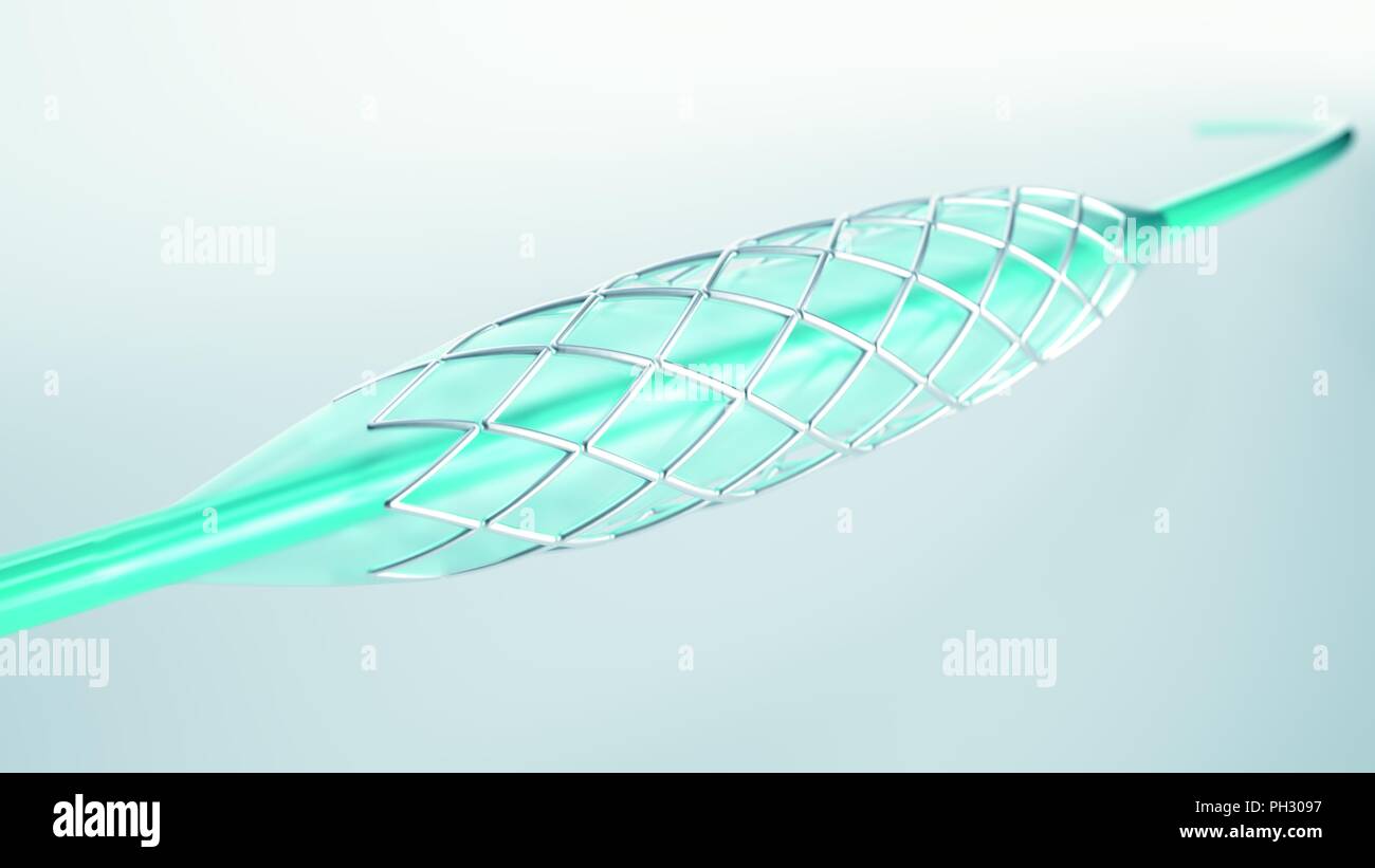 Coronary stent hi-res stock photography and images - Alamy