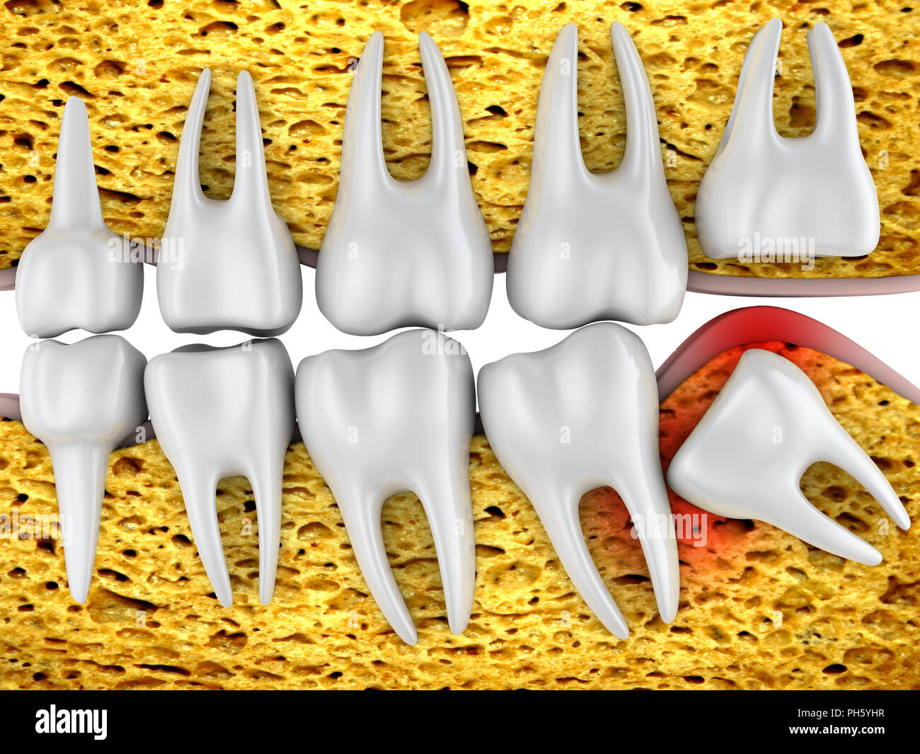 Crowding Teeth High Resolution Stock Photography and Images - Alamy