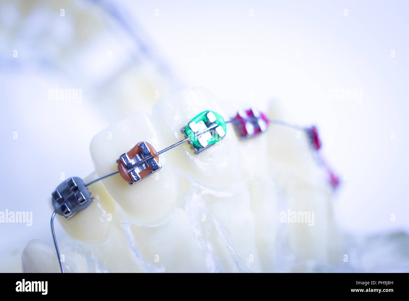 Dental metal braces teeth retainer aligners teaching orthodontics model ...