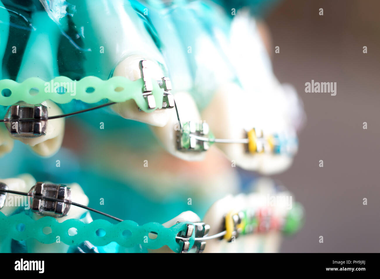 Dental metal braces teeth retainer aligners teaching orthodontics model ...