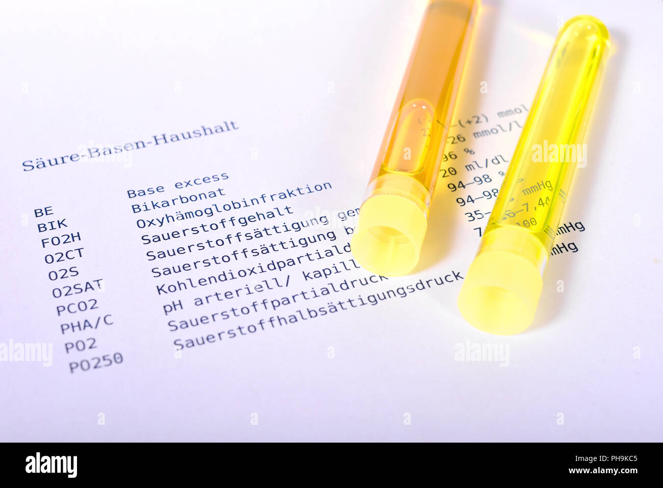 Urine test laboratory urine Stock Photo - Alamy