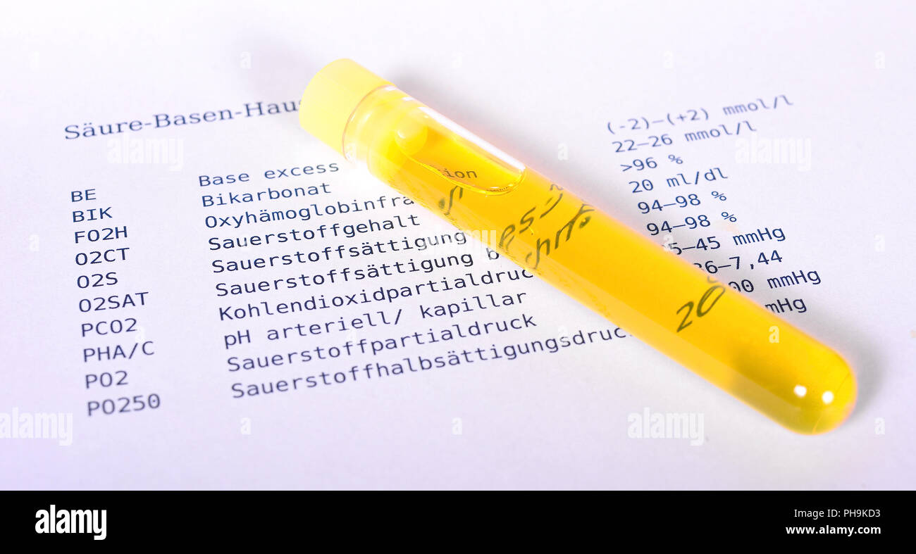 Urine test laboratory urine Stock Photo - Alamy