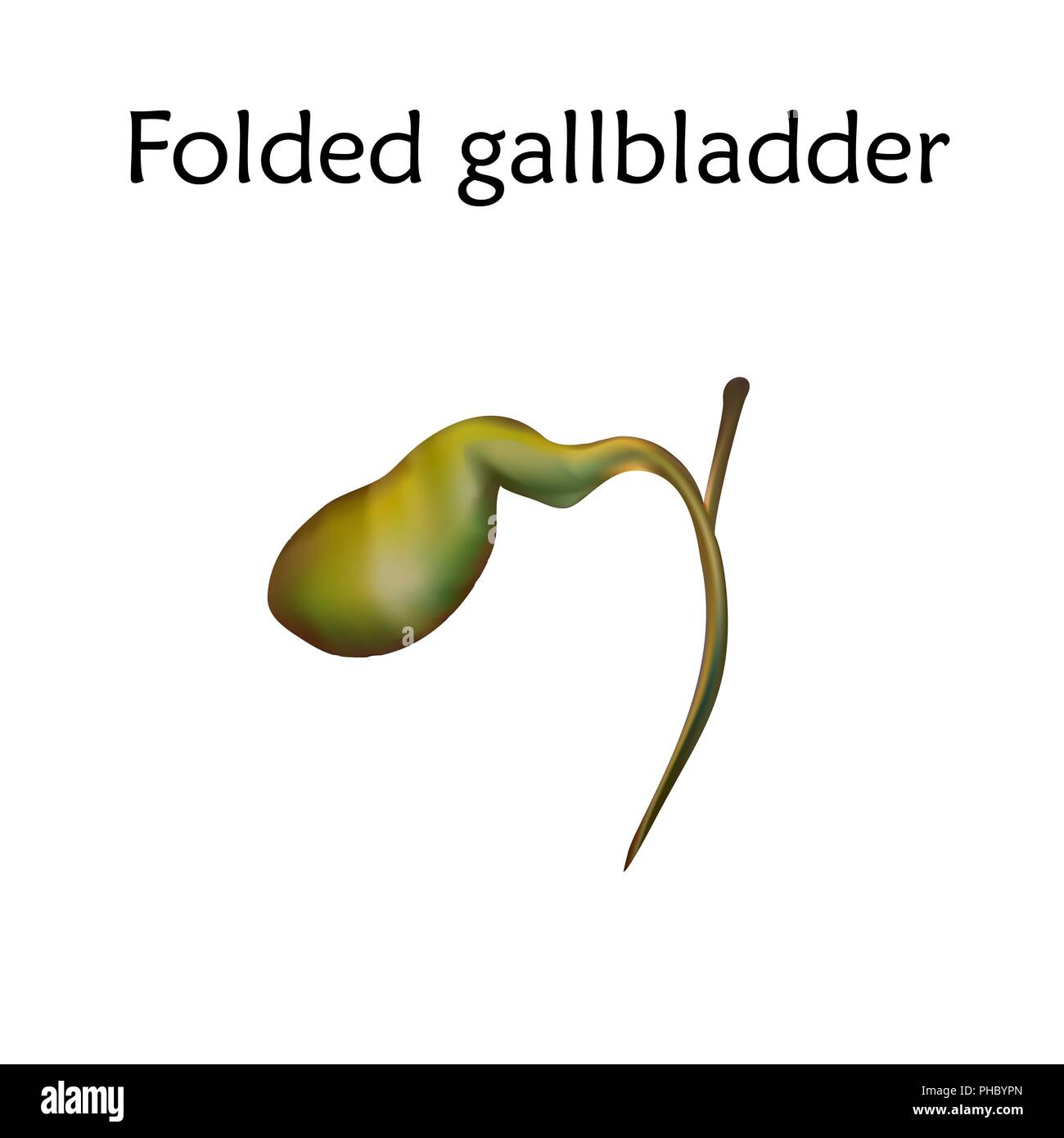 Folded gallbladder, illustration Stock Photo - Alamy