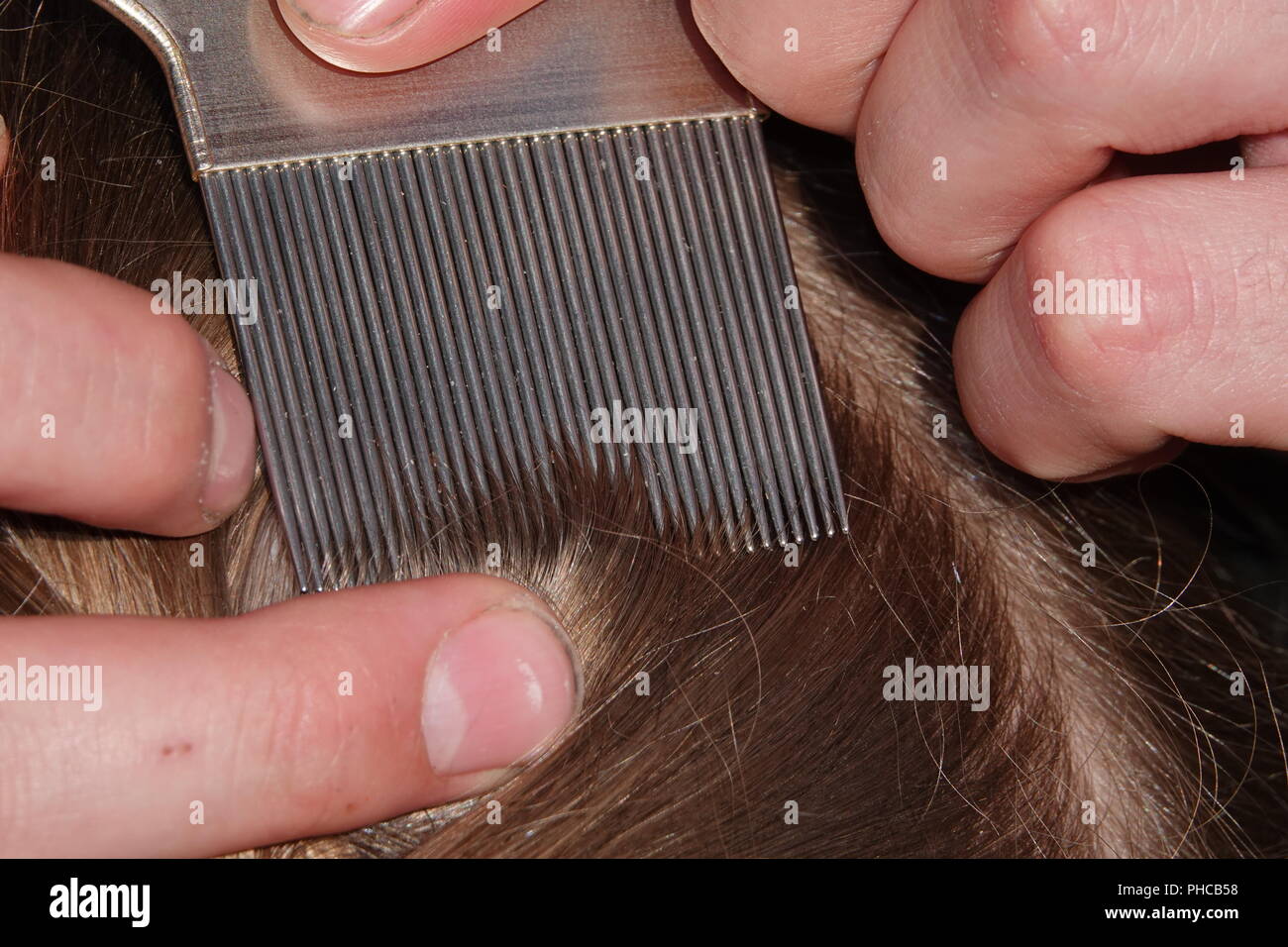 Head lice infection common in young people. Hair being checked using a ...