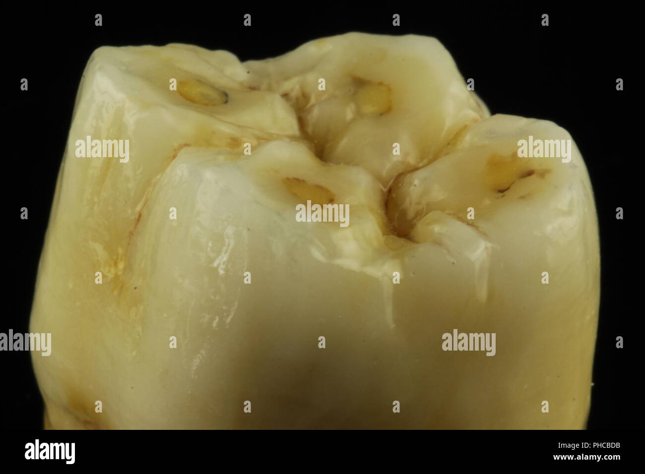 Dental art work hi-res stock photography and images - Alamy