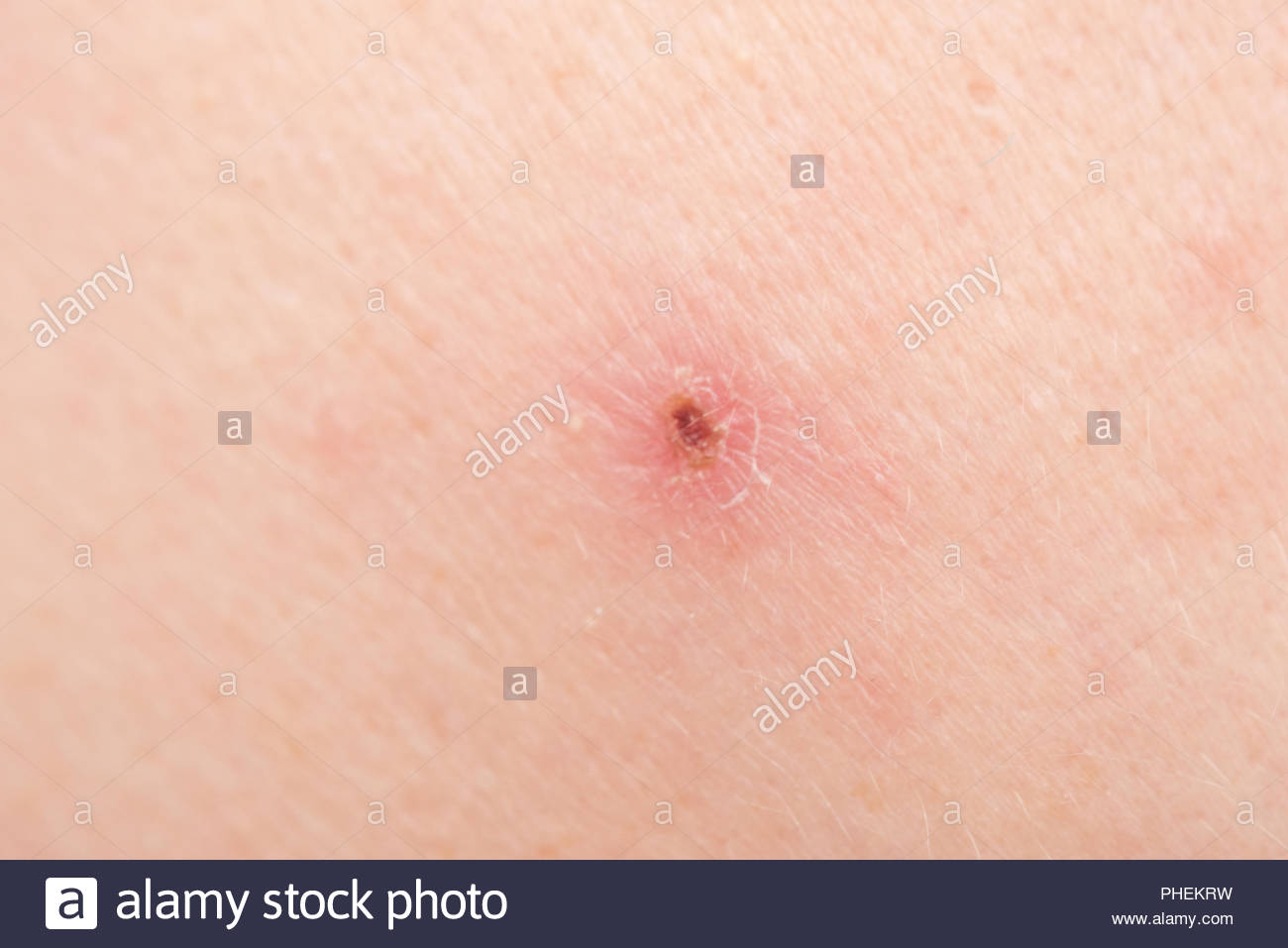 Chicken Skin Texture Stock Photos & Chicken Skin Texture Stock Images ...